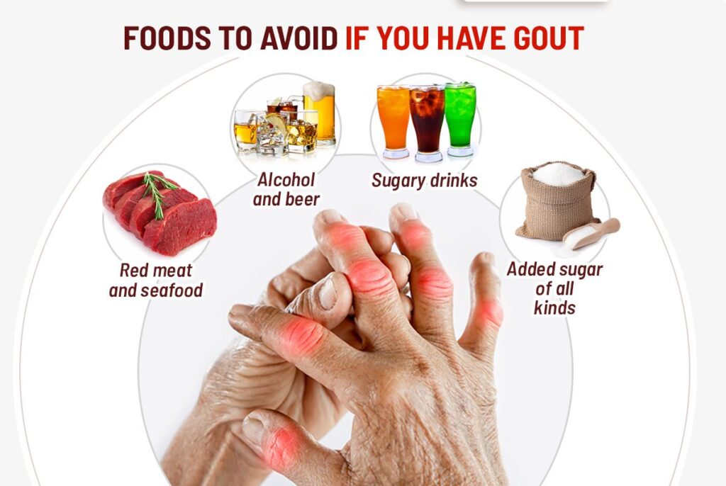 Foods That Fight Gout | Dr Qaisar Ahmed MD, DHMS | Best Homeopathic ...